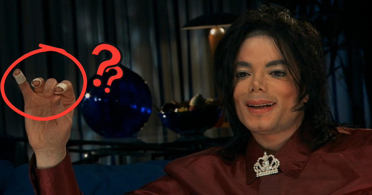 The real reason Michael Jackson always wore tape on his fingertips
