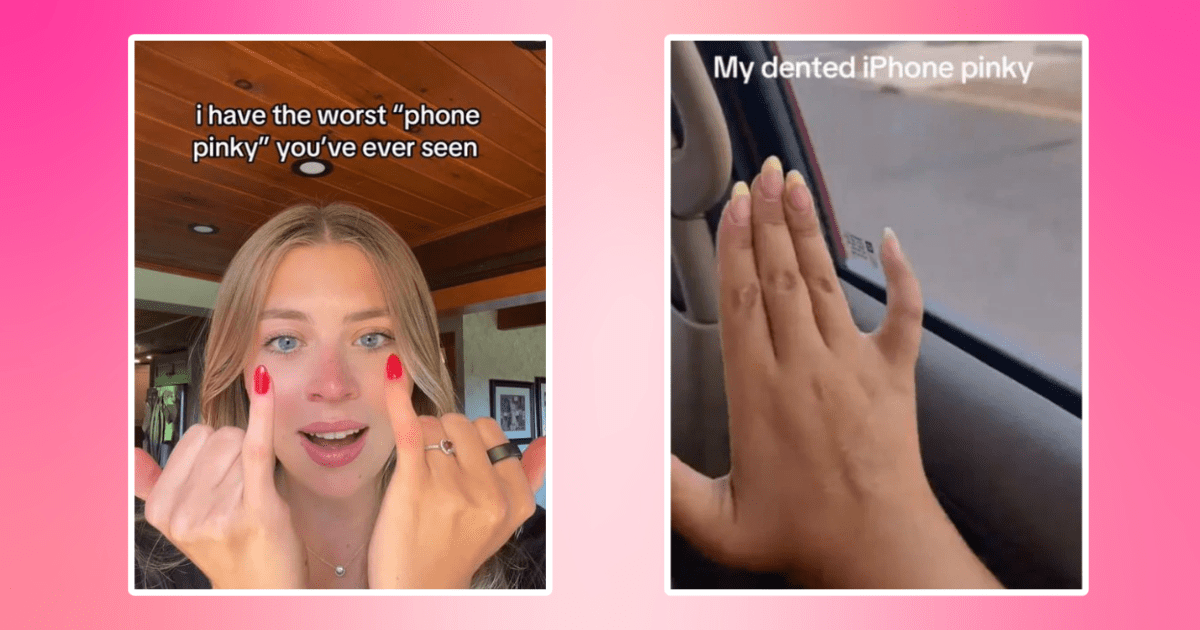What is phone pinky on TikTok and how can you tell if you have it or not?