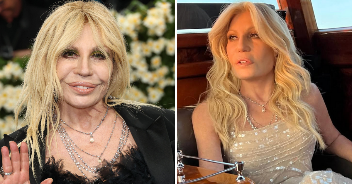 Expert reveals why Donatella Versace's face looks so different