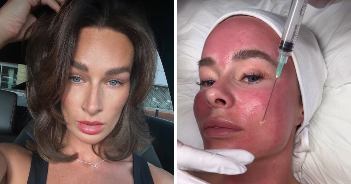 All the cosmetic surgery the MAFS UK 2025 cast have had done